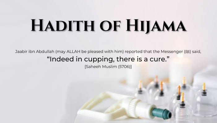 Unlocking Wellness: The Timeless Wisdom of Hijama from Quran and Sunnah ...